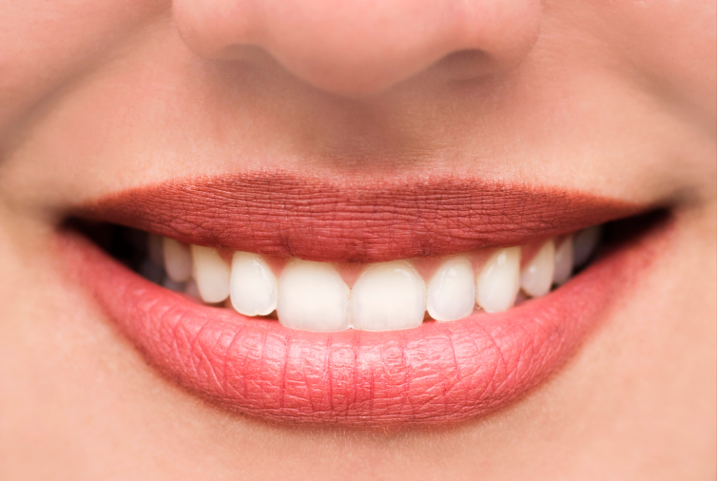 Lip Lift San Diego, CA | Lip Enhancement Chula Vista, CA | Lip ...